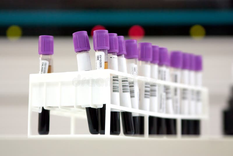 Rack with Test Tubes of Blood Editorial Photo - Image of doctor, adult ...