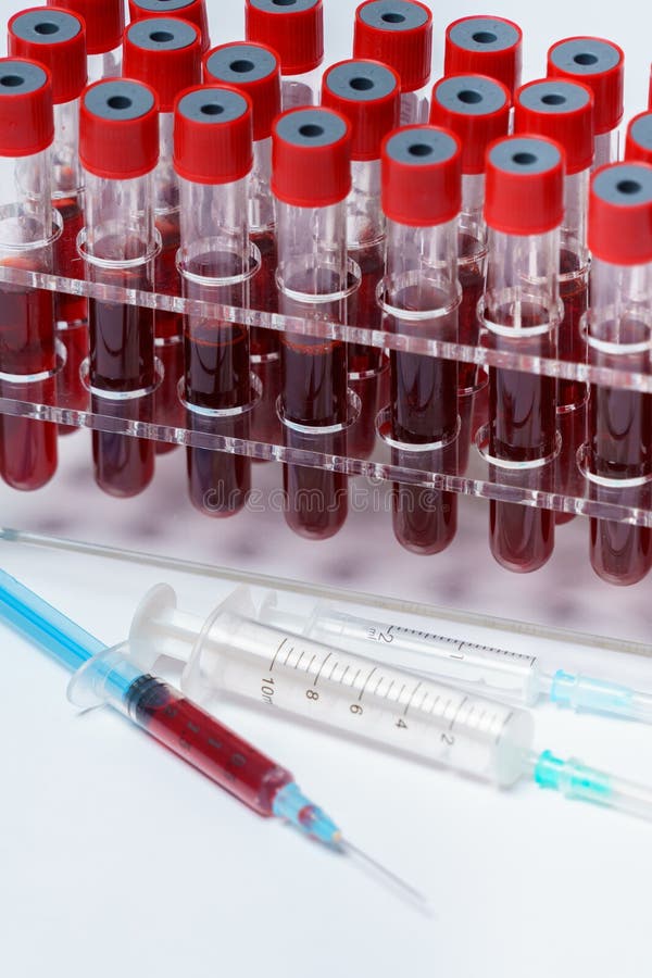 Rack with Tubes with Blood Samples from Patients for Analysis in the ...