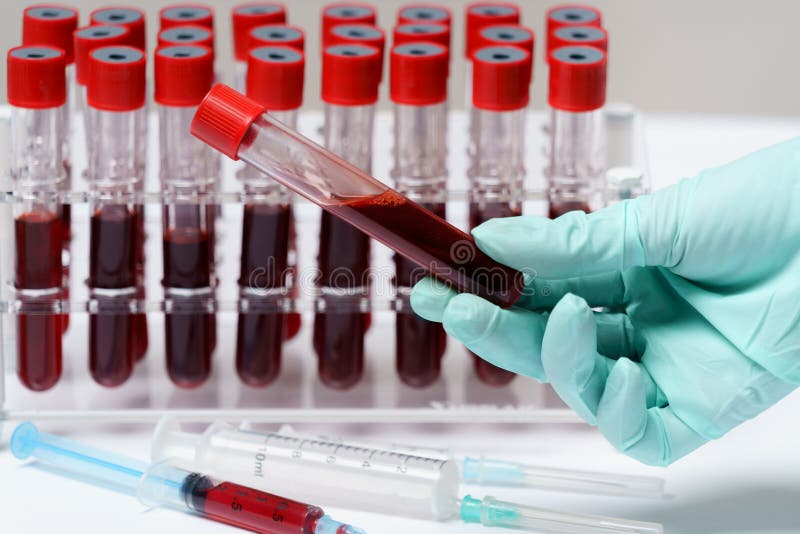 Rack of blood tubes with stock image. Image of hand - 130579859