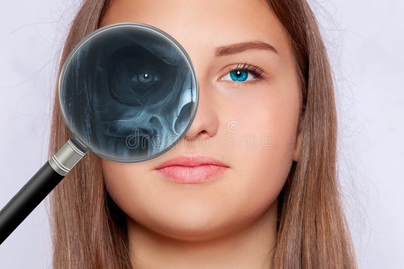 Radiografia Da Face, Oftalmologia Imagem de Stock - Imagem de crânio ...