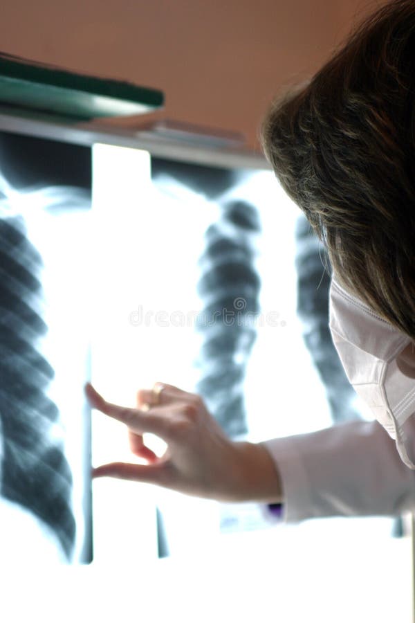 Radiography stock image. Image of medical, stern, radiography - 14039359
