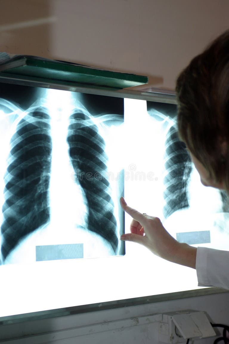 279 Stress Radiography Stock Photos - Free & Royalty-Free Stock Photos ...