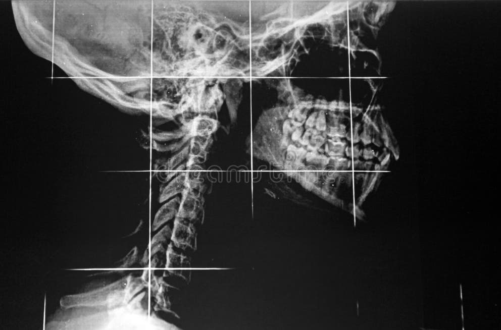 Radiography stock image. Image of anatomy, radiology - 23902391