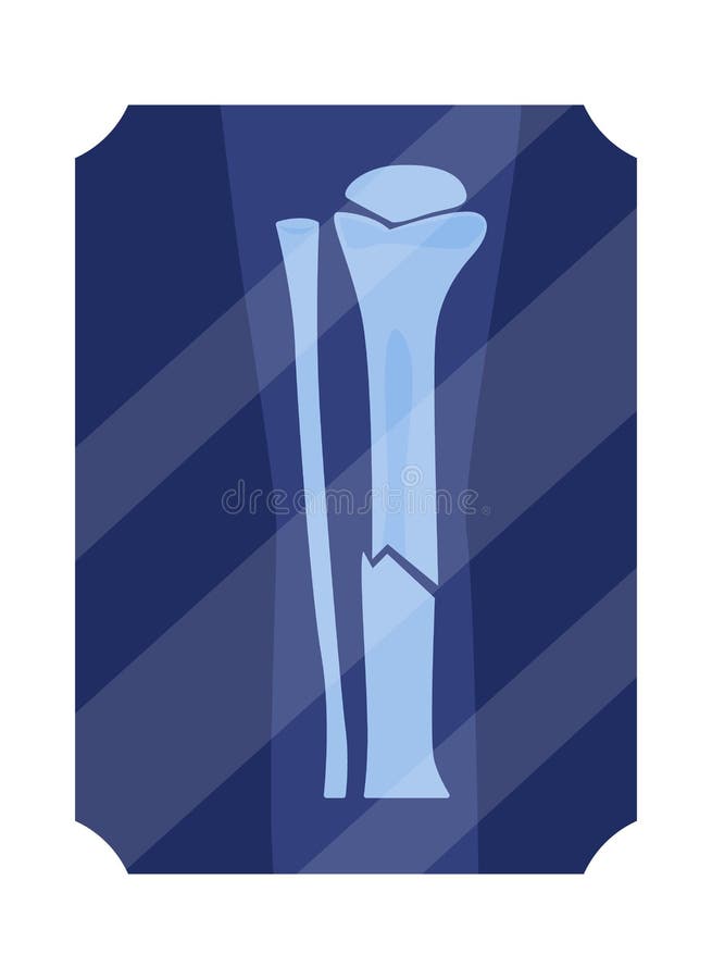 Radiography Test Pixel Perfect RGB Color Icon Stock Vector ...