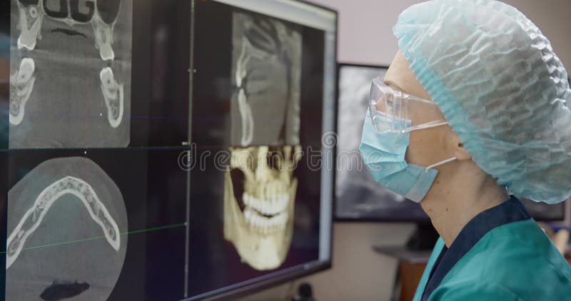 Radiologist Dentist Doctor Looking at Teeth 3D X-ray on Desktop ...