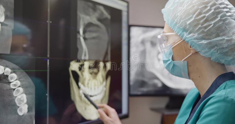 Radiologist Dentist Doctor Looking at Teeth 3D X-ray on Desktop ...