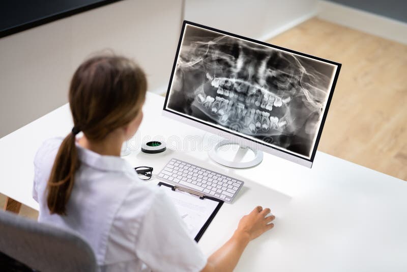 Radiologist Dentist Using X Ray Software Stock Photo - Image of dental ...