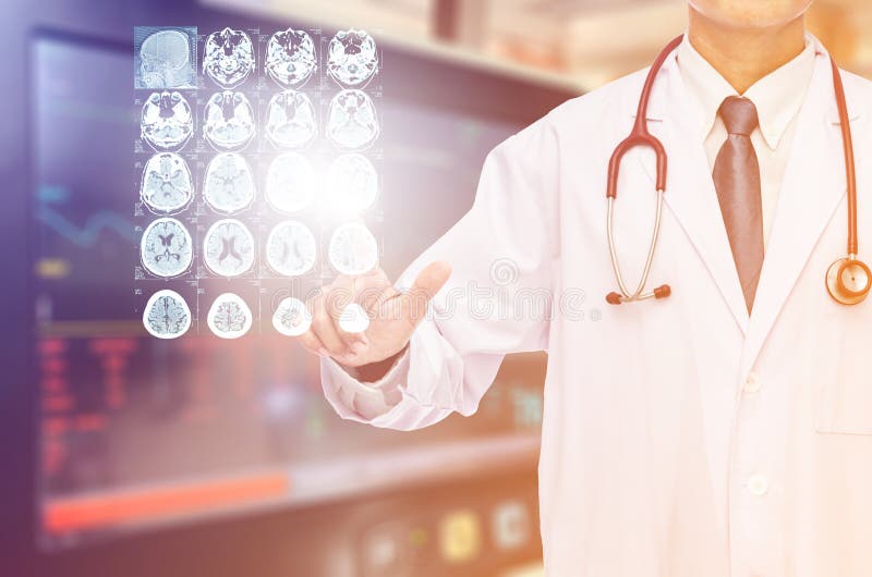 Radiologist Doctor Touching Film Brain MRI Stock Photo - Image of ... Radiologist Doctor Touching Film Brain MRI Stock Photo - Image of ...