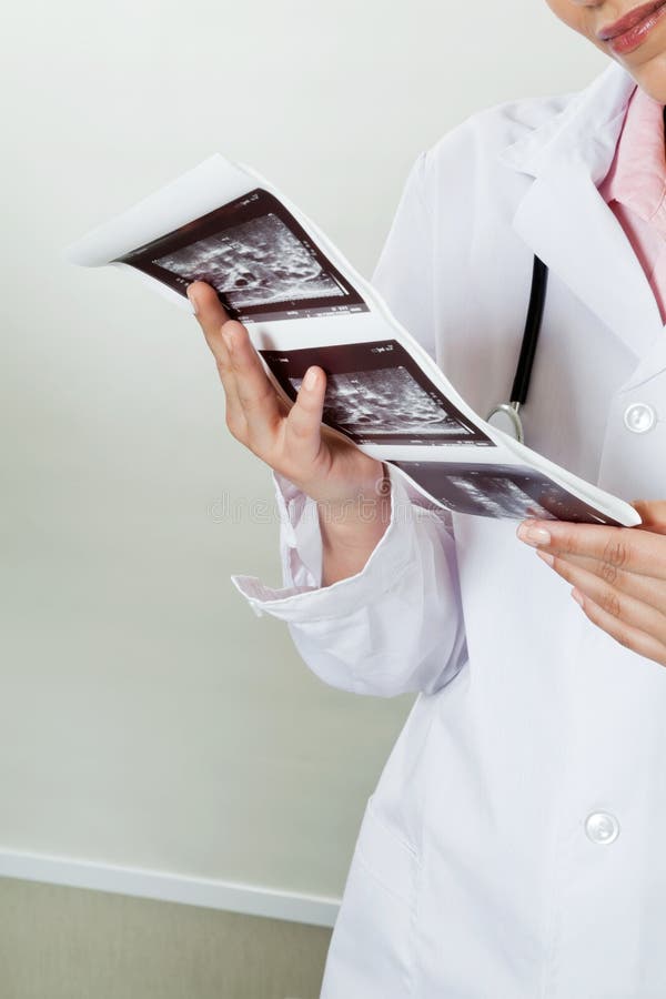 Radiologue Holding Ultrasound Print Image stock - Image du santé ...