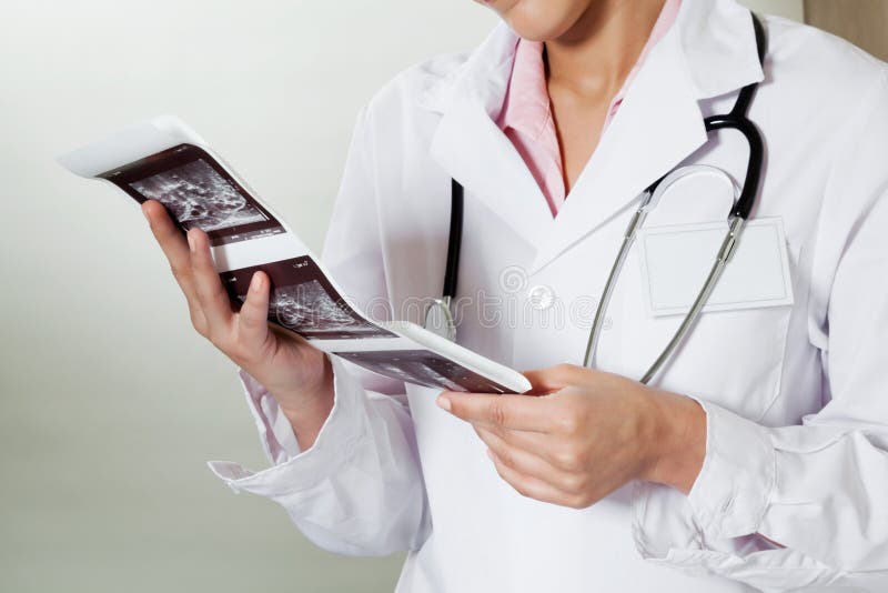 Radioloog Holding Ultrasound Print Stock Foto - Image of status ...