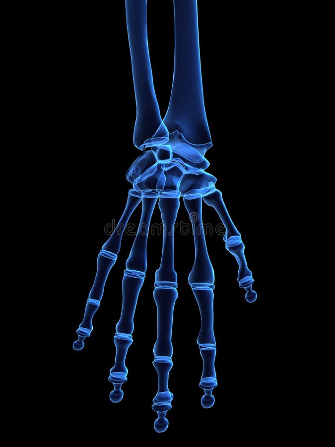 Radiografia Di Una Mano Umana Illustrazione di Stock - Illustrazione di ...
