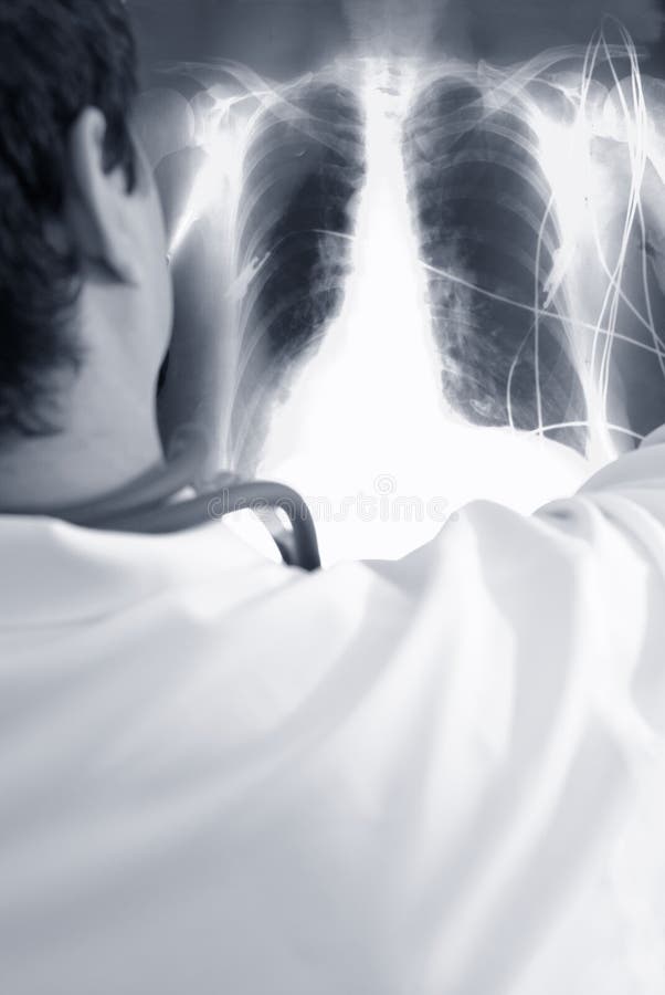 Radiografia immagine stock. Immagine di bianco, raggio - 4480465