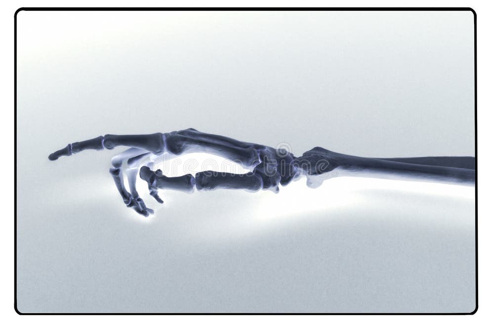 Raio X Da Mão E Do Antebraço Humanos Foto de Stock - Imagem de medicina ...