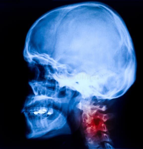 Raio X principal imagem de stock. Imagem de radiologia - 31448429