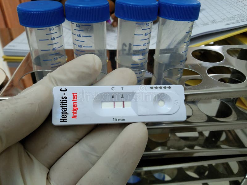 Rapid Test Cassette for Hepatitis Virus Test. Stock Photo - Image of ...