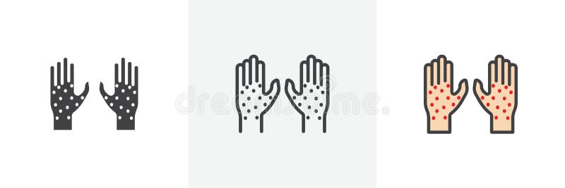 Rash on hand and arm skin stock vector. Illustration of inflammation ...