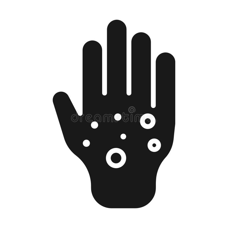 Rash on hand and arm skin stock vector. Illustration of treatment ...