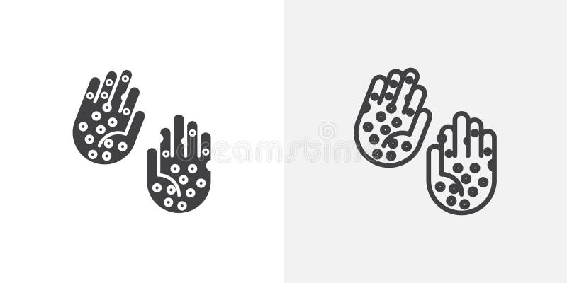 Rash on hand and arm skin stock vector. Illustration of treatment ...