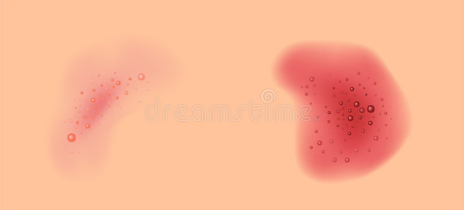 Collagen Serum Cosmetic Skin Care Stock Vector - Illustration of ...