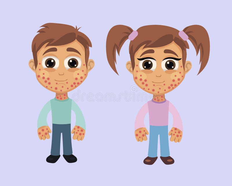 Rash Symptom stock vector. Illustration of skin, adorable - 88572093