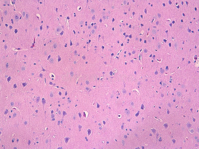 Rat Brain Hippocampal Neurons Stock Photo - Image of neuron, micrograph ...