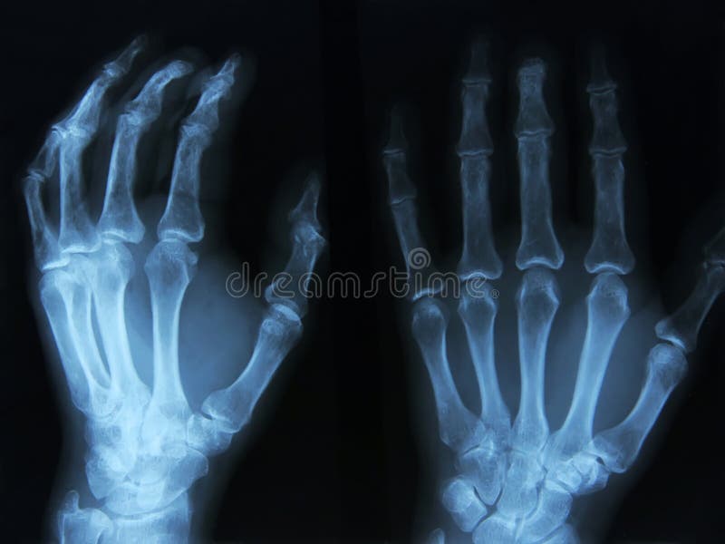 Rayon X. image stock. Image du technologie, radiogramme - 20505297