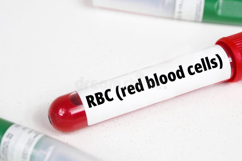 RBC (red Blood Cells) Title Text of Medical Analysis Stock Photo ...
