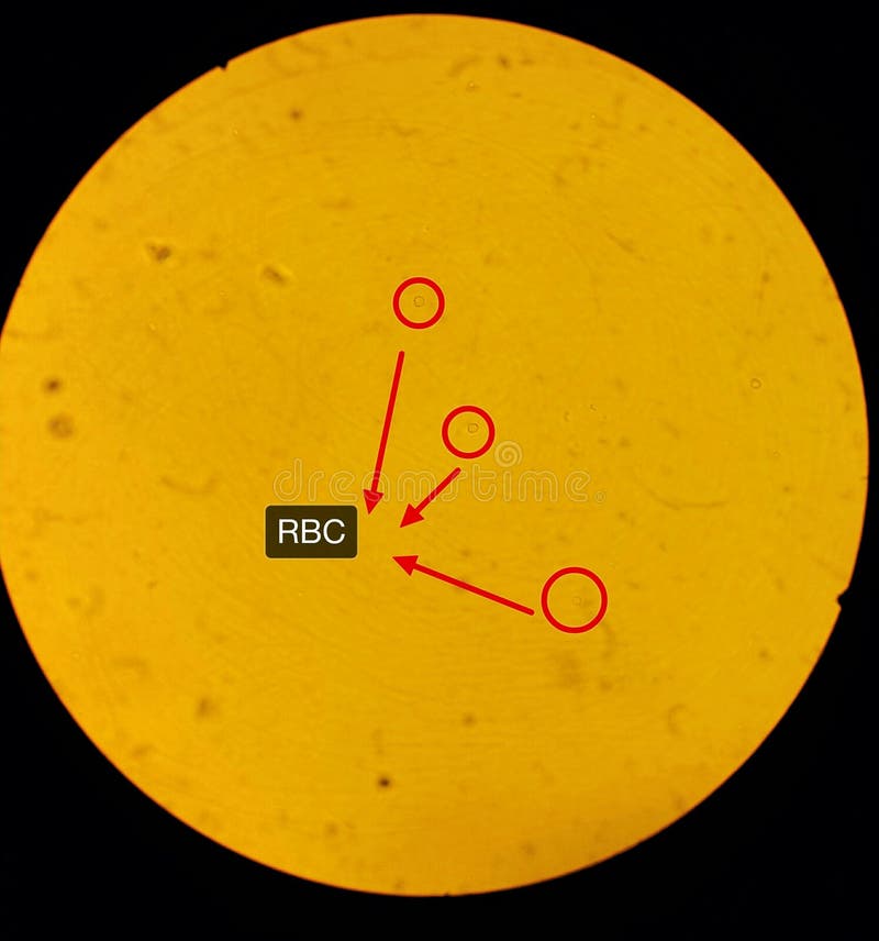 Urine Under Microscope Stock Photos - Free & Royalty-Free Stock Photos ...