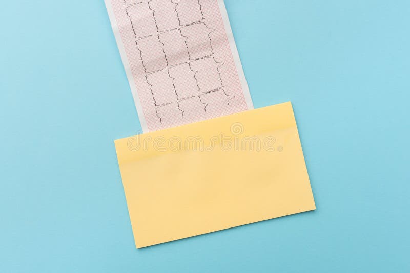 Reading Graph and Writing Important Medical Notes Test Result Analysis ...