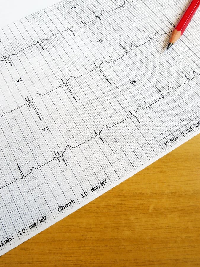 Reading medical ECG chart stock image. Image of healthcare - 28936169