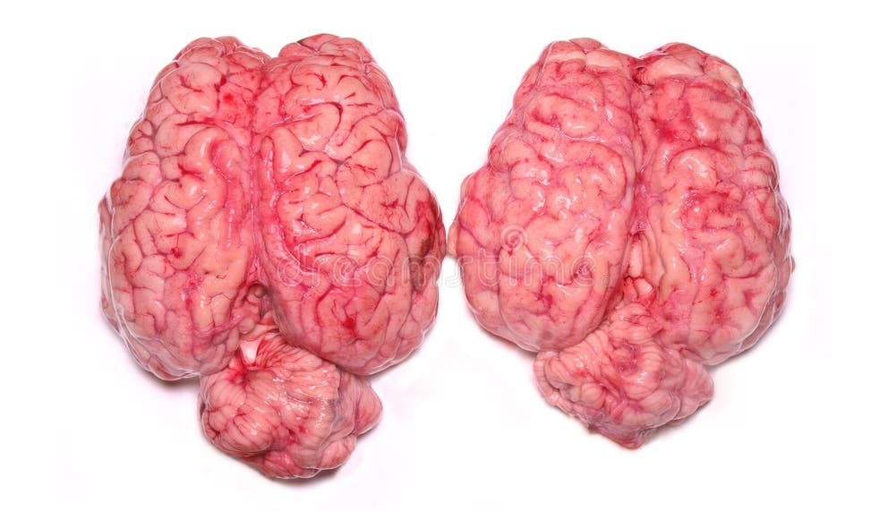 Real Brains stock image. Image of surgery, human, nervous - 1807493
