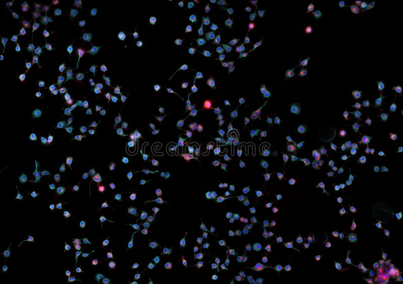 Real Fluorescence Microscopic View of Cancer Cells Stock Photo - Image ...