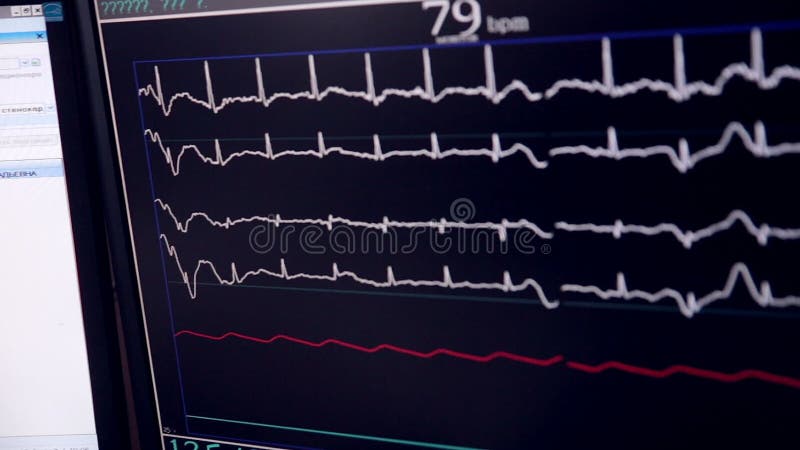 Real Heart beat pulse. stock footage. Video of graphic - 74677518