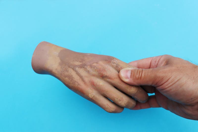A Real Human Hand Holding an Artificial Plastic Hand. Stock Image ...