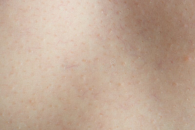 Real human skin stock photo. Image of pink, abstract - 78657638