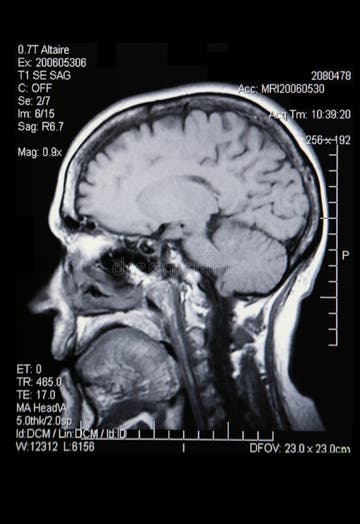 A real MRI/ MRA stock photo. Image of injury, patient - 2167670