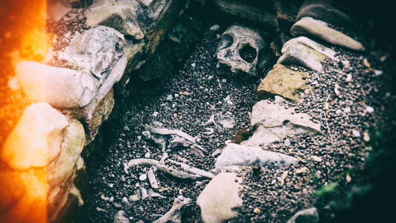 Real Skeleton X-ray of Woman Knee Suffering from Rheumatism. Stock ...