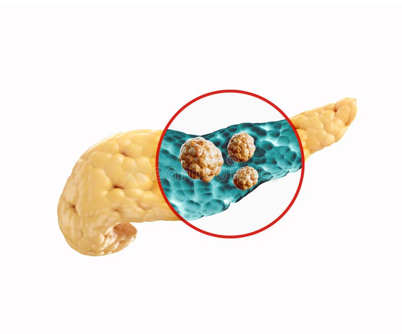 Realistic 3d Illustration of Human Pancreas Isolated on White Stock ...