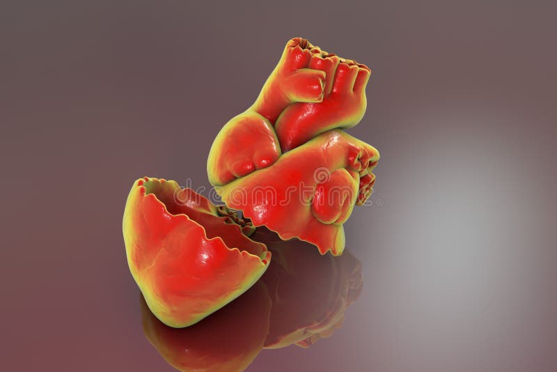 Realistic Broken Heart, Separation and Divorce Concept Stock ...