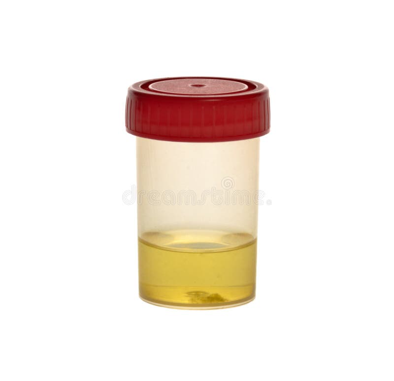Recipiente da urina foto de stock. Imagem de médico, urina - 15345388