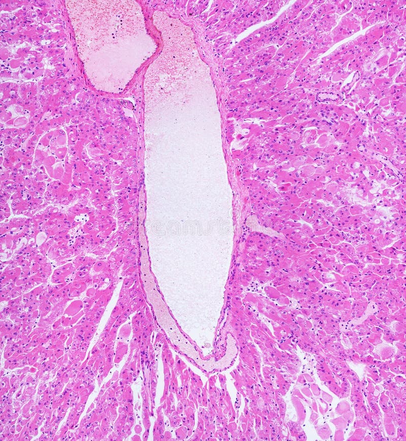 La Célula Reticular Es Un Tipo De Fibroblasto Se Encuentran En Muchos ...