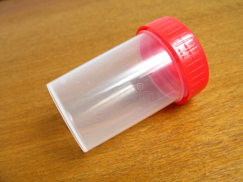 Recipiente médico da urina imagem de stock. Imagem de anormalidade ...