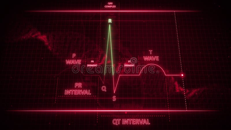 R Wave from Electrocardiogram Wave or ECG or EKG Stock Illustration ...