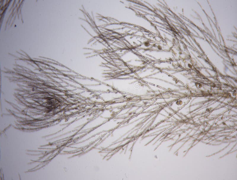 Red Algae Under the Microscope Stock Image - Image of meerwasser ...