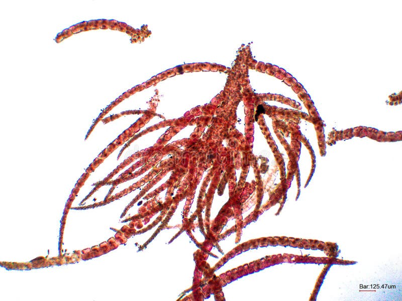 Red Algae Microscope