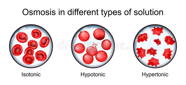 Red Blood Cell in Hypertonic, Hypotonic and Isotonic Solution Stock ...