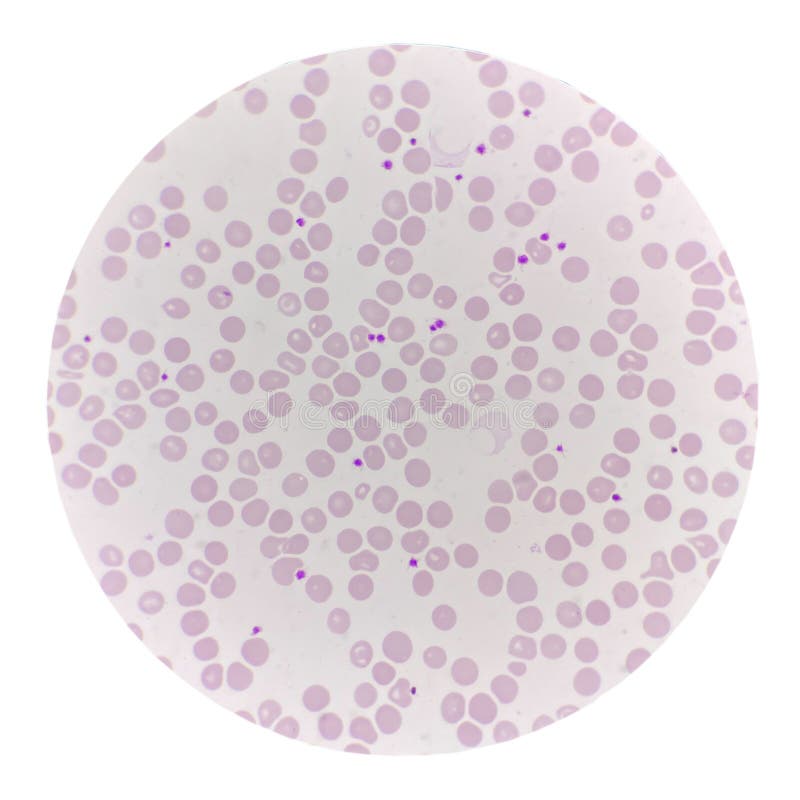 Red Blood Cell with Platelet in Blood Smear Stock Illustration ...