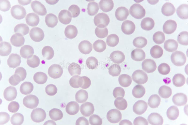 Red Blood Cells and Platelet in Blood Smear Stock Image - Image of ...