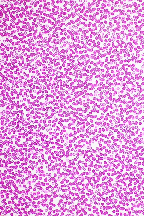 Red Blood Cells and Platelet in Blood Smear Stock Image - Image of exam ...