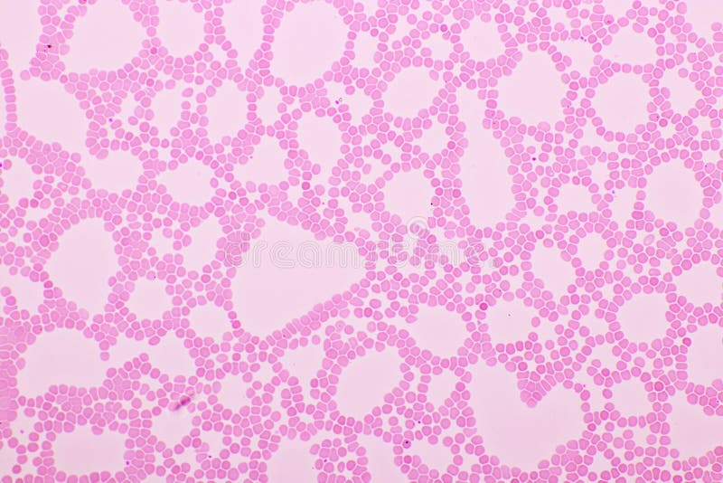 Red Blood Cells in Blood Smear Stock Image - Image of cells, hematocrit ...